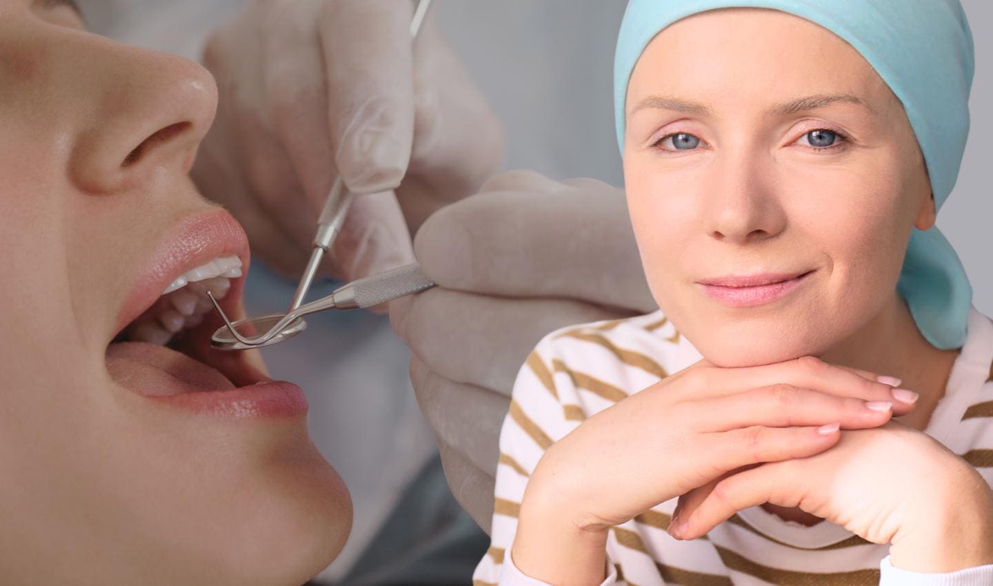 Mucositis Oral: Prevención, diagnóstico y tratamiento